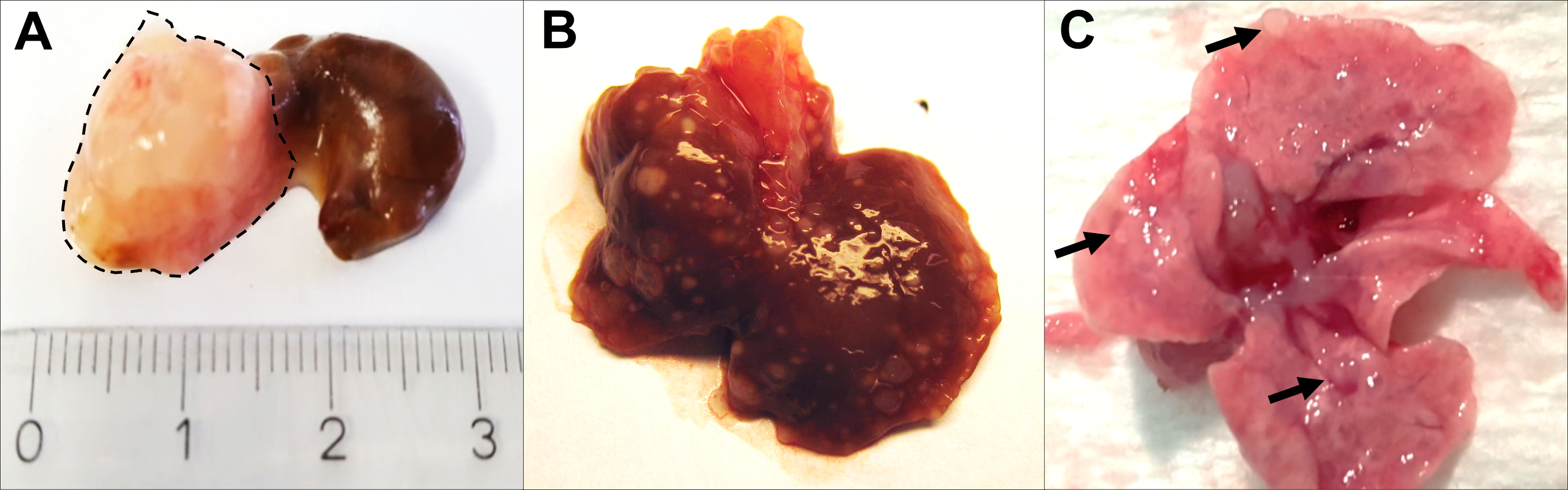 Isolation of Circulating Tumor Cells in an Orthotopic Mouse Model of ...